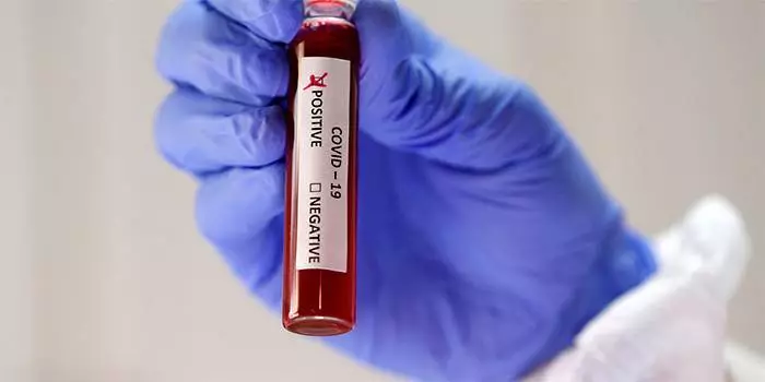 Testbuis mei in positive test foar coronavirus