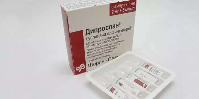 Diprospan 用于治疗眼部痱子