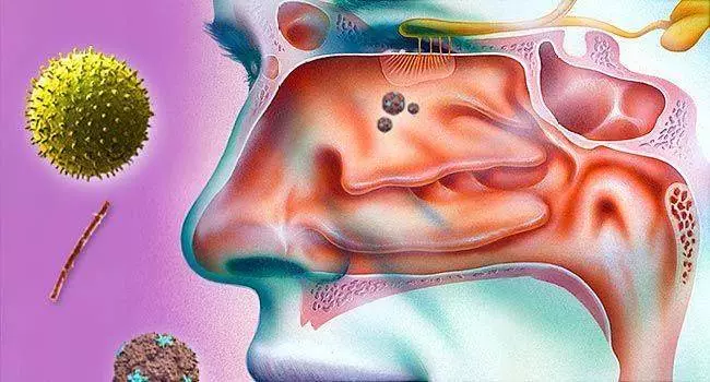 Alesan kanggo kurang ambune ing infeksi coronavirus 10186_1