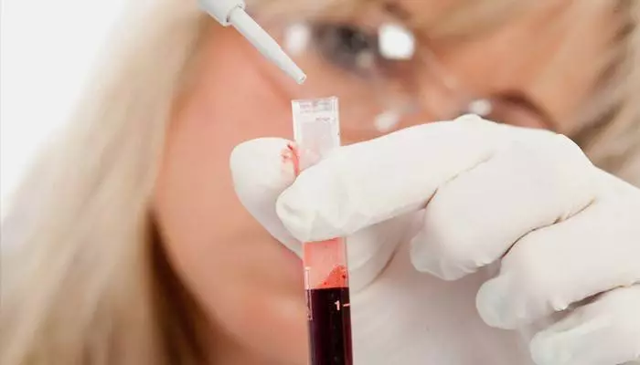 Lab technician examines the analysis