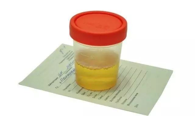 Analisi delle urine