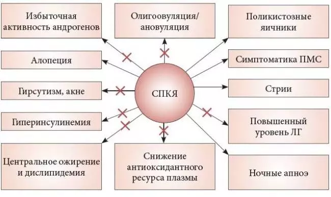 Причини, симптоми и ефекти на синдром на полицистични јајници 10973_2