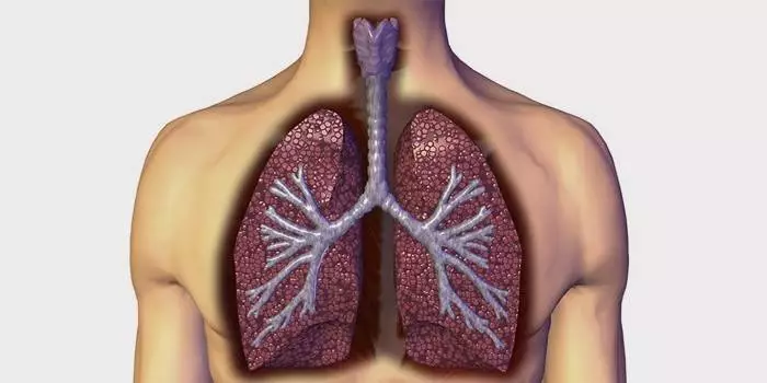 Symptomer vun der Bronchial Tuberkulose