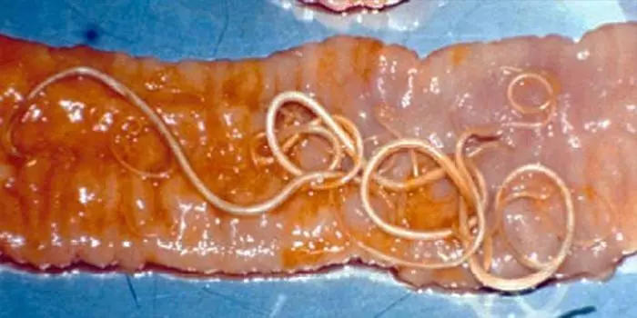 Roundworms na obere eriri afọ mmadụ