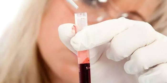 혈액 검사를 하는 실험실 조수