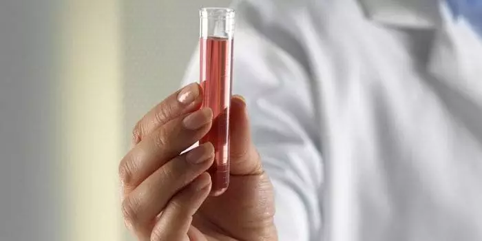 En læge holder et reagensglas med et stof i hånden