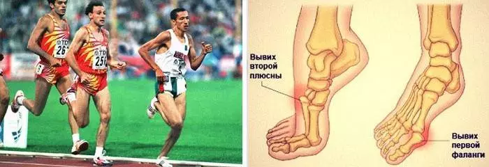 बड़े पैर की उंगलियों में दर्द क्यों होता है