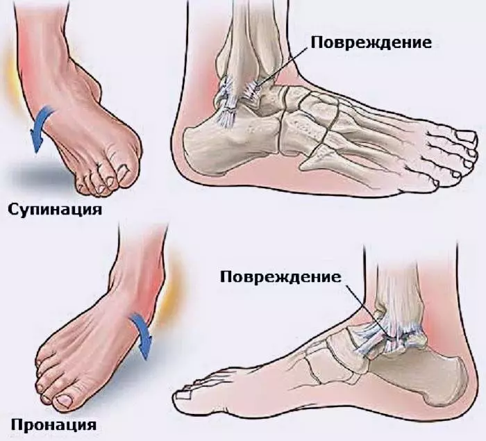 Dhimbje kyçin e këmbës
