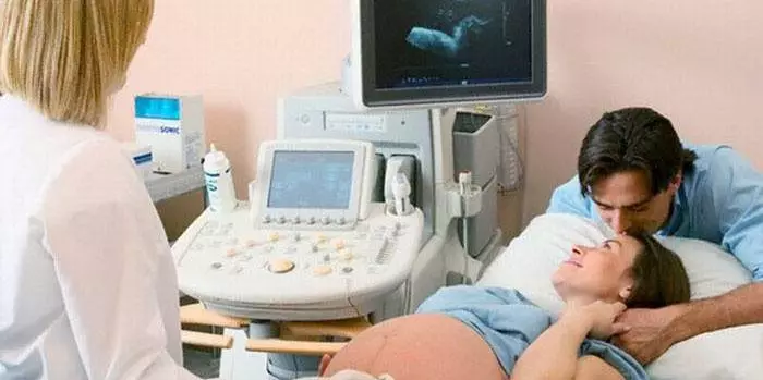 Schwangeren muss Ultraschall verschrieben werden