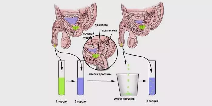 Teknîkî ji bo pêkanîna masaja prostatê bi tiliyek