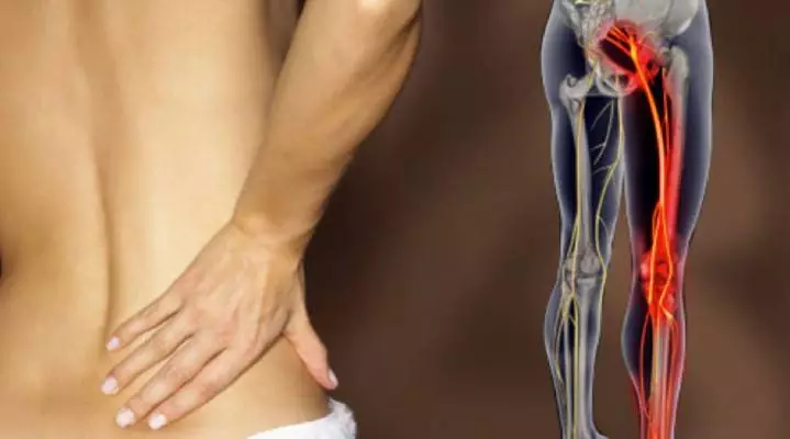 Lumbodynia tulang punggung lumbar - ngilangi rasa sakit ing wilayah sakral, obat kanggo kejang ing otot punggung