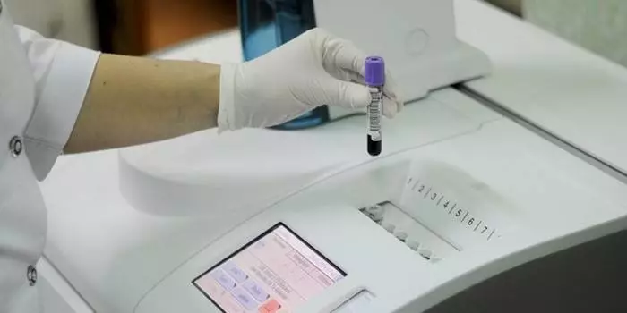 PCR analüüs ureplasmoosi tuvastamiseks