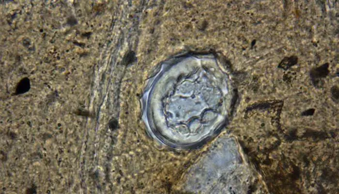 हेल्मिंथ अंडे के लिए सूक्ष्म परीक्षा की छवि