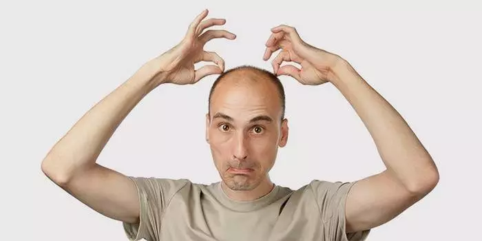 A man with a bald head