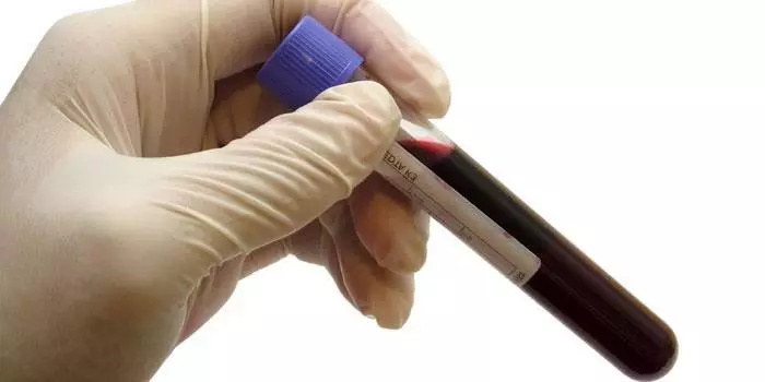 Δοκιμαστικός σωλήνας με αίμα στο χέρι
