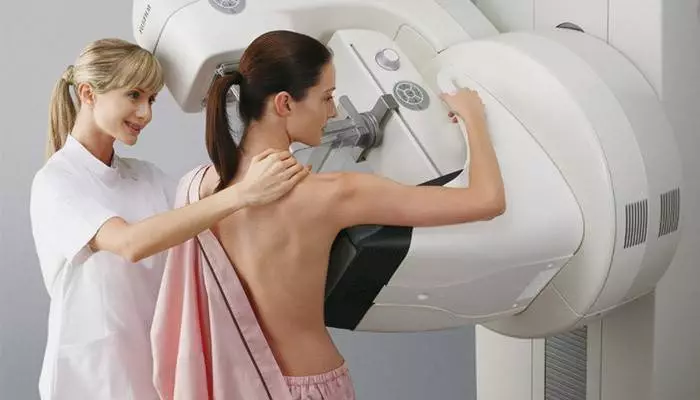 Дзяўчына робіць маммограмму