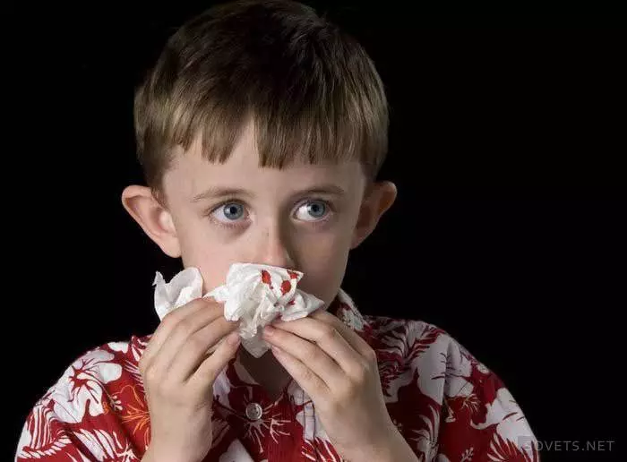 Kā pareizi apturēt deguna asiņošanu maziem bērniem?