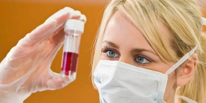 Pige holder et reagensglas med blod