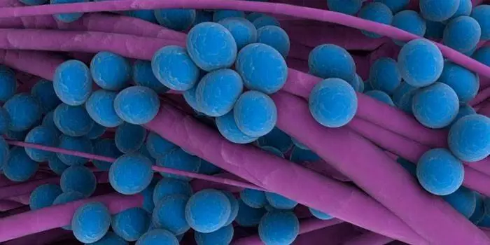 ភ្នាក់ងារបង្ករោគ staphylococcus