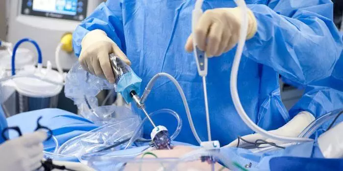 El cirurgià realitza una operació laparoscòpica