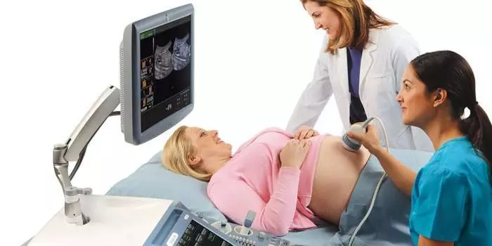 Mujer embarazada, en, ultrasonido