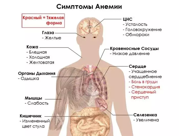 Симптоми на анемия