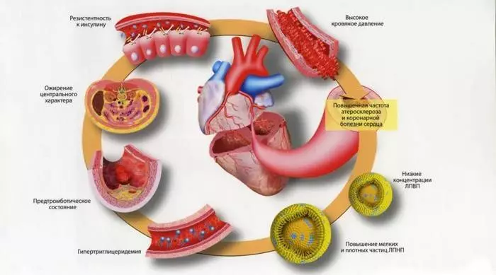 Effects of LDL Cholesterol Accumulation