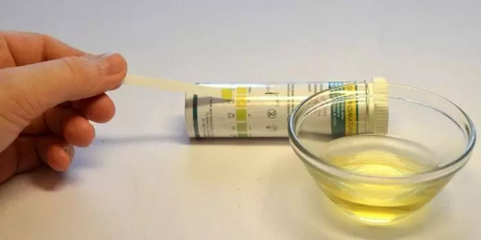 Normalt urinproteintall