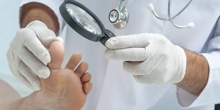 Kiểm tra các vết chai sần trên bàn chân