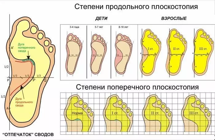 Tingkat pelanggaran struktur kaki pada diagram