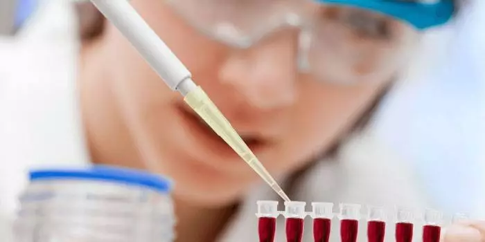 Laboratorieassistent laver en blodprøve