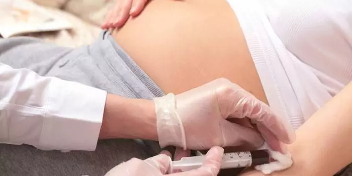 Kraujas iš venos paimamas iš nėščios moters analizei