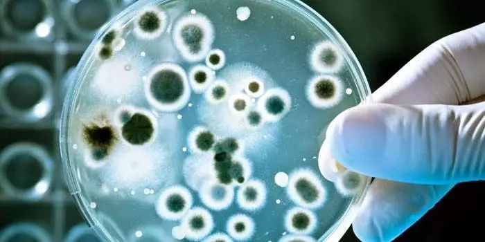 Cultivo bacteriano nunha placa de Petri