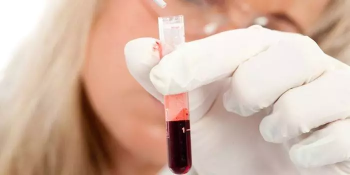 Bloed Test