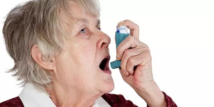 Une femme souffre d'asthme bronchique