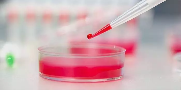 glycated hemoglobin جو تجزيو