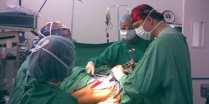 Dokters tydens chirurgie