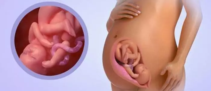 Feto a 36 settimane di gestazione