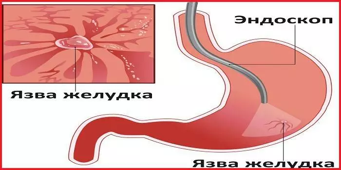 Ашказаны ярасы