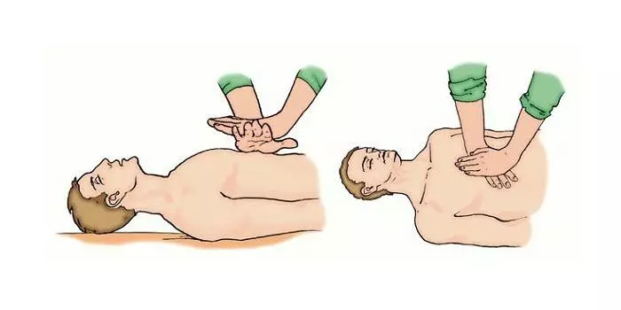 Scéim indíreach massage cairdiach