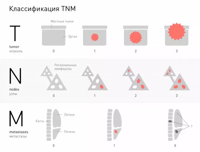 TNM классификациясы