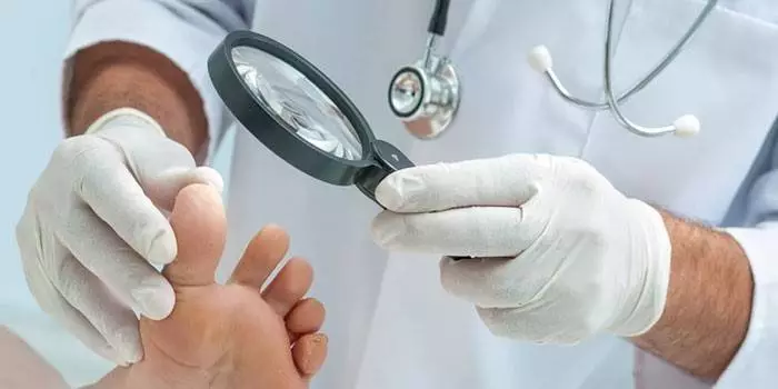 Der Arzt untersucht den Fuß des Patienten mit einer Lupe