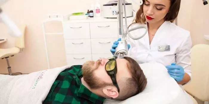 Lékař provádí laserové odstranění névusu na obličeji muže