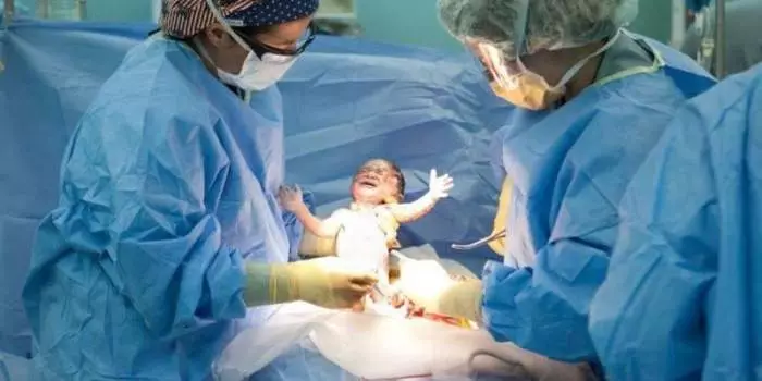 Ndị dọkịta na -eme ngalaba caesarean