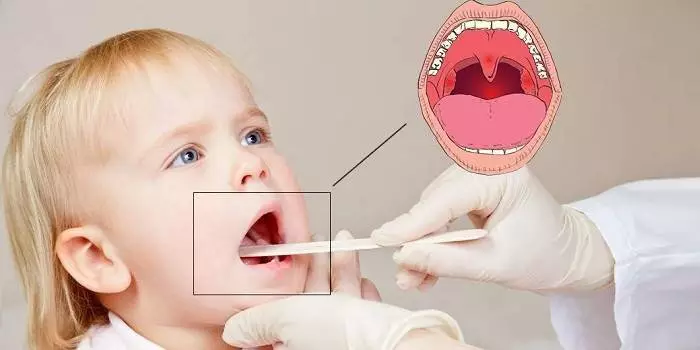 Лекарот го испитува грлото на детето