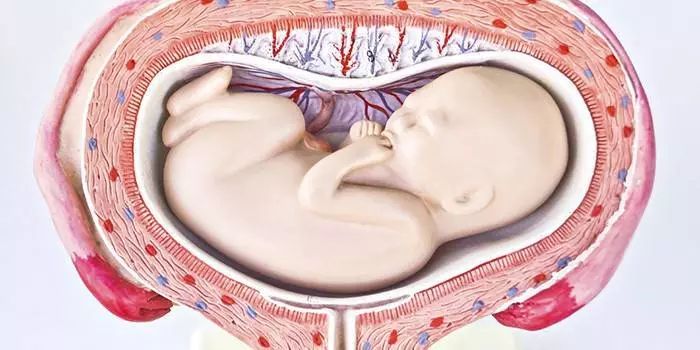 Localização transversal do feto no útero