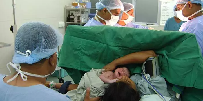 Un equipo médico en el quirófano realizando una cesárea