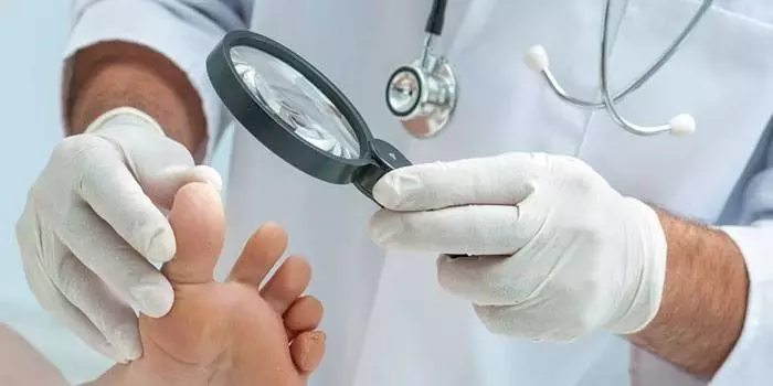 Dokter memeriksa kaki pasien melalui kaca pembesar