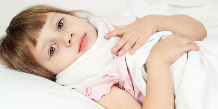 อาการเจ็บคอในเด็ก - สัญญาณแรก, การรักษาที่มีประสิทธิภาพที่บ้าน, ภาวะแทรกซ้อนที่เป็นอันตราย