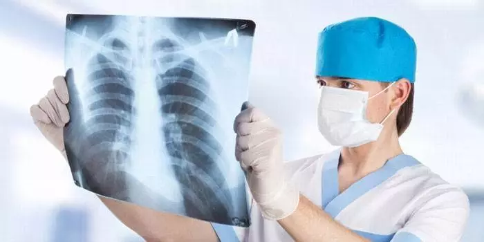 De dokter kijkt naar de röntgenfoto van de longen